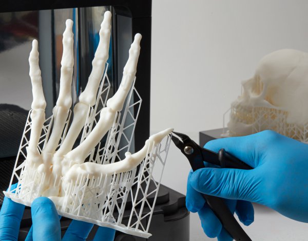 3D Printing for Hospitals