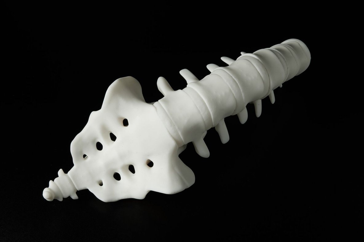 3d printed bones for surgery
