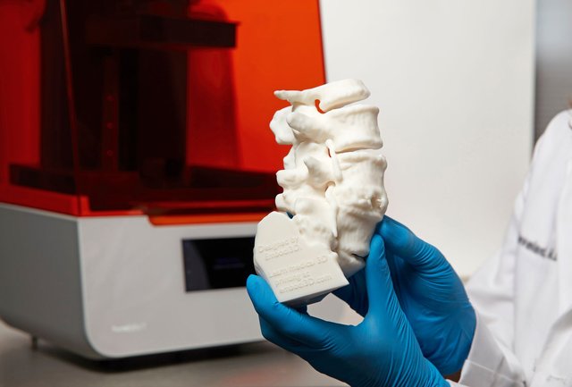How 3D Printing is Being Used Right Now In Spinal Surgery | Formlabs