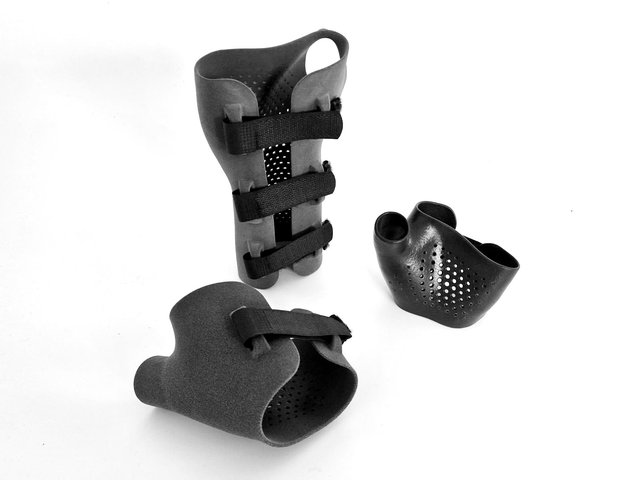 Designing and Producing Hand Orthosis With Artus3D and the Fuse ...